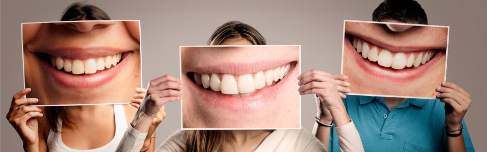 What Makes Our Smiles Unique | Dental Solutions